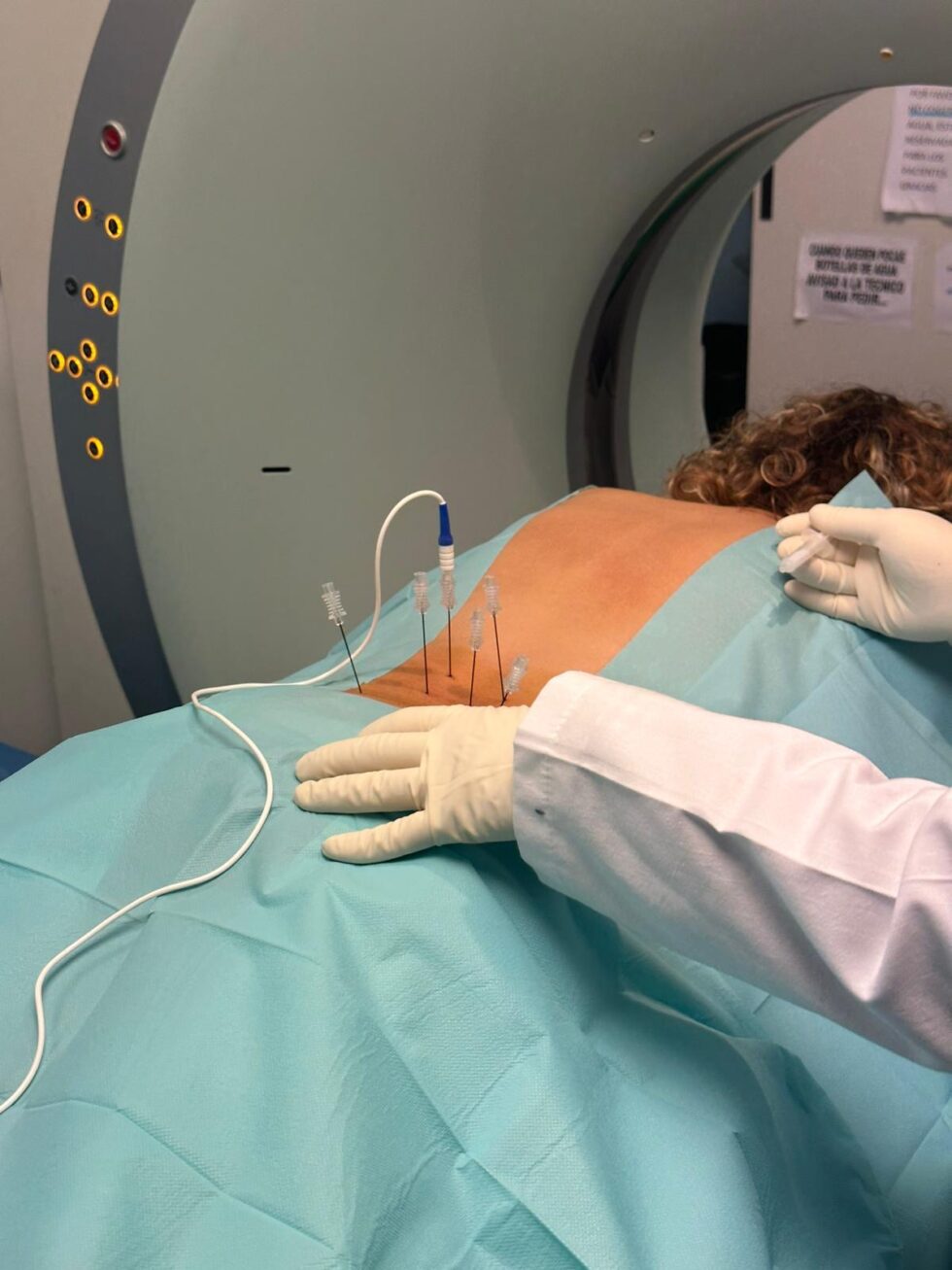 Rizólisis. | Doctor Valle Folgueral